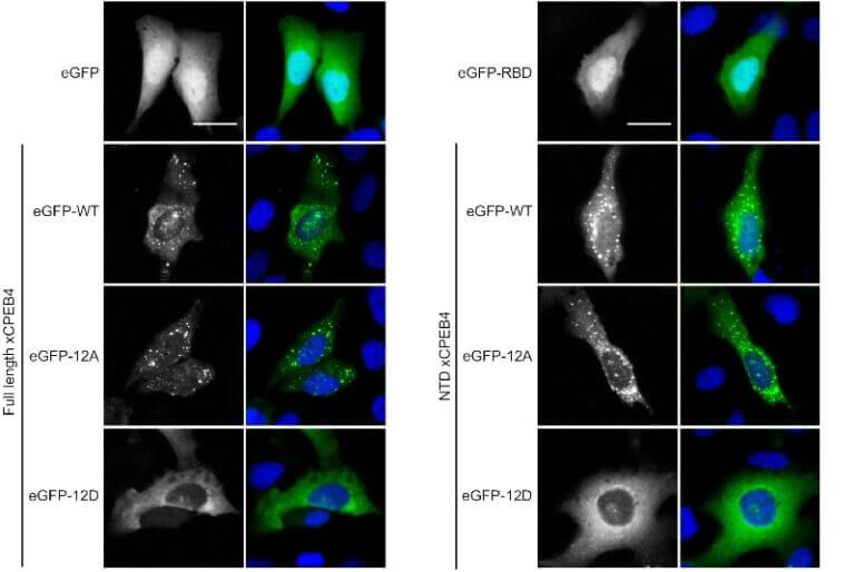 Towards a better understanding of the puzzling “droplets” in the cell ...